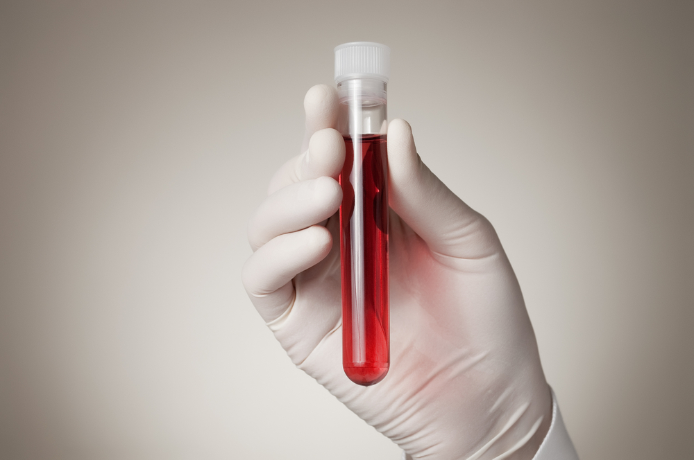 Blood Analysis: Unlock the Body’s Secrets to Reach Peak Performance ...